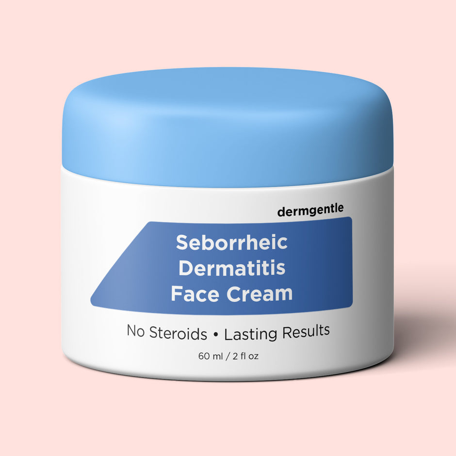 Seborrheic Dermatitis Relief Cream | Dermgentle – dermgentle